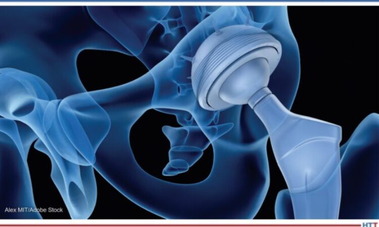 TITANIUM HEAT TREATING - Heat Treat Today